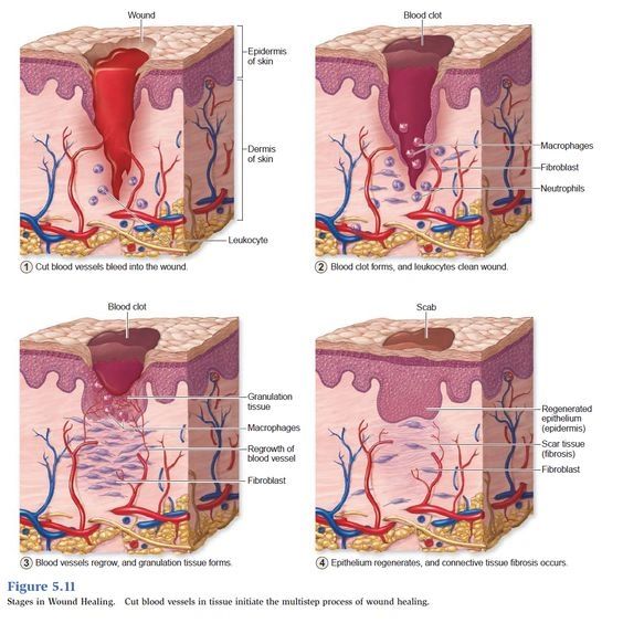 Granulation Tissue Wound Healing